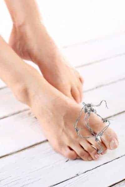 Psoriasis pied, comment s'en débarrasser, sans corticoïdes