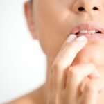 Boutons autour de la bouche : causes, traitements, prévention