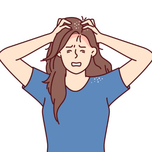 Psoriasis et perte de cheveux, causes, symptômes traitements